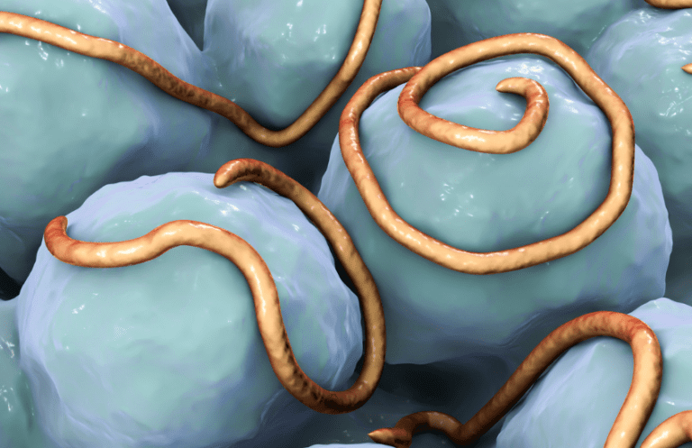 Are Pinworms Dangerous? Here’s How to Get Rid of Internal Parasites in ...